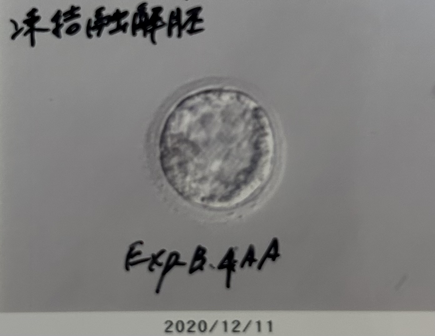 【体外受精】BT0～BT6まで！体調の変化をまとめました！BT6の妊娠検査薬あり！ - 主婦の時間