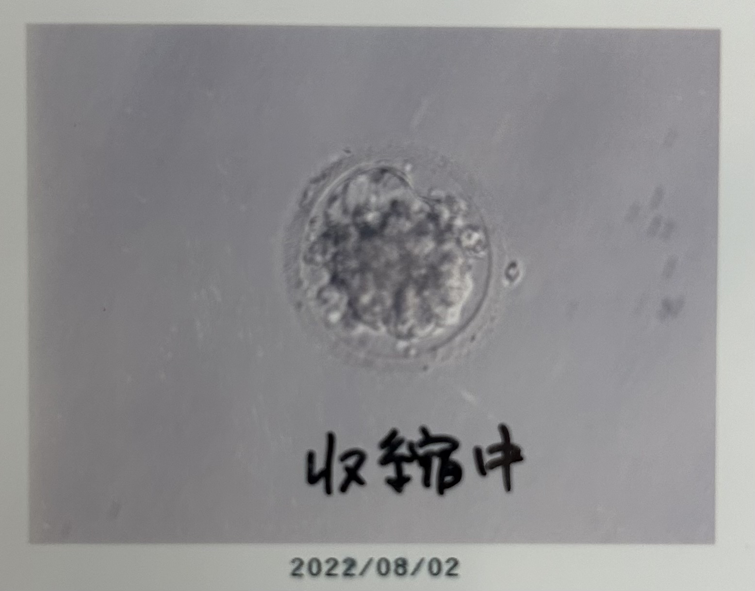 【2人目不妊】・【体外受精】BT0～BT6の体調の変化まとめ！BT6でフライング検査実施！ - 主婦の時間